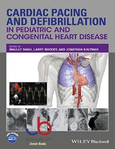 Cardiac Pacing and Defibrillation in Pediatric and Congenital Heart